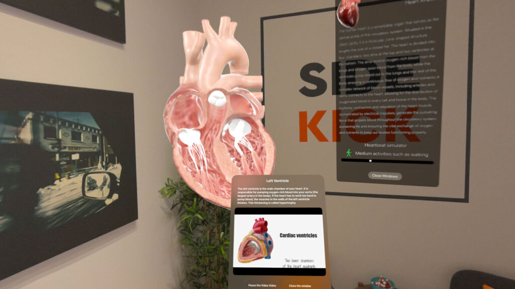 HP Arize - Custom 3D orthotics | Sidekick Interactive